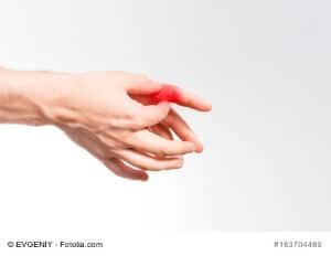 Blaue Finger – Was bedeutet die Blaufärbung der Fingerkuppen?